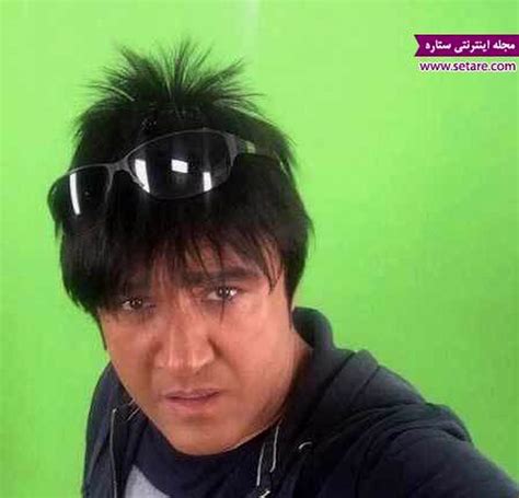 دگرگونی رامبد جوان با کاشت مو 30 سال جوانتر شد عکس