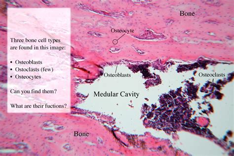 Medullary Cavity Of Developing Bone