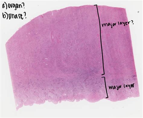 Anatomy Lab Exam Female Reproductive Histology Flashcards Quizlet