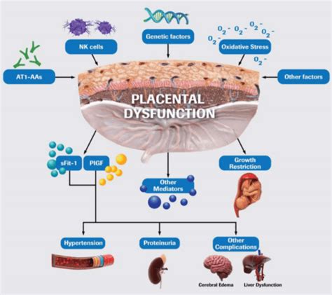 Roche Diagram Predicting Preeclampsia