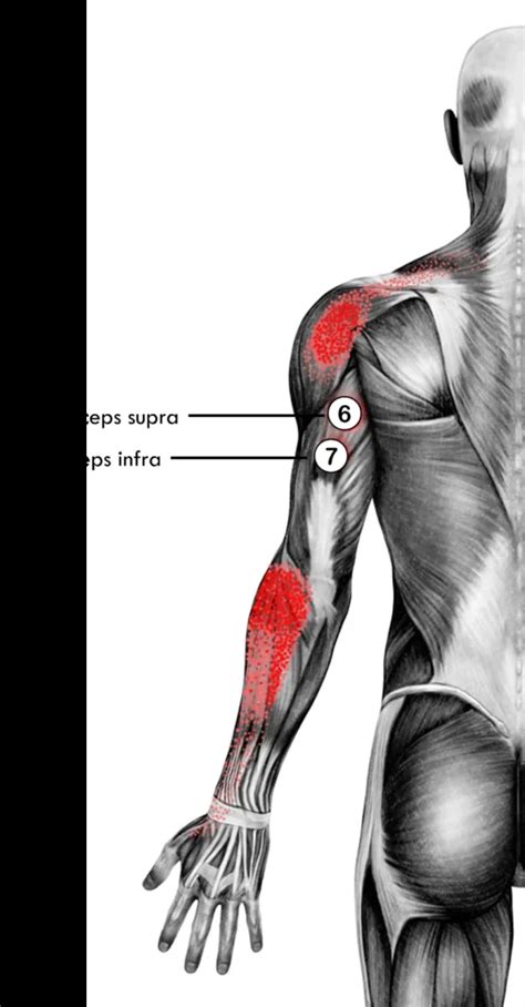 Arms Trigger Points The Tides BrainBodyMind Wellness