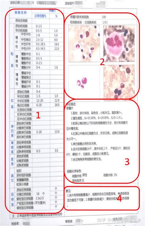 这样看骨穿报告医生懂得您也懂 知乎