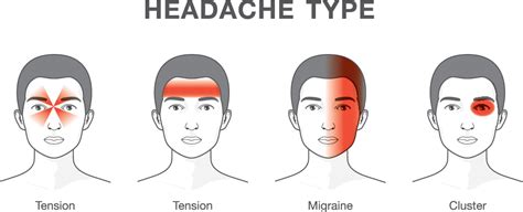 Headache Clinic Kings Daughters Health System