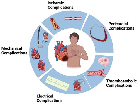Complications In Acute Myocardial Infarction N