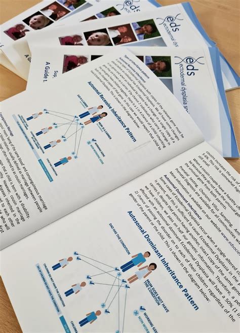 A Guide To Ectodermal Dysplasia The Ed Society