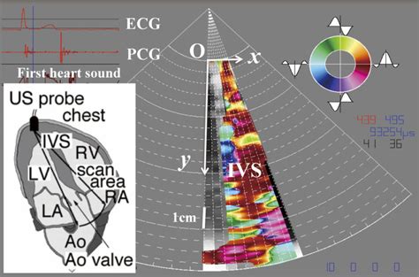 Color Online Snapshot Of Two Dimensional Spatial Pattern Of The Phase