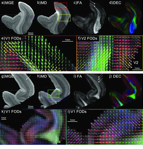 4 Maps Of Diffusion Metrics For Sample B Refer To The Caption Of 3 For Download Scientific