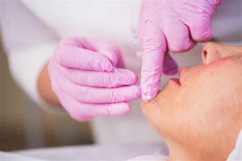 รูปภาพmicroinjection เลือกดูภาพถ่ายสต็อก เวกเตอร์ และวิดีโอ154 Adobe Stock