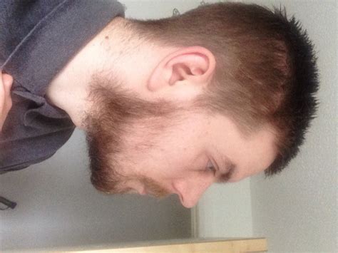 Pains Patchy Beard Journey Soon To Be Weeks Update Page Beard Board