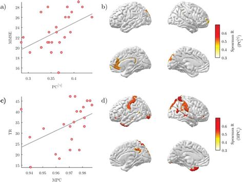 Correlation Between Brain Network Properties And Cognitivememory