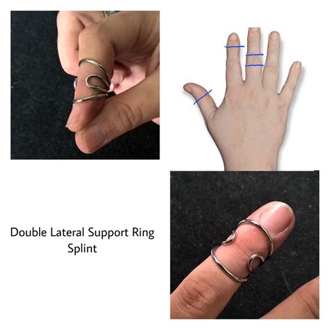 Double Lateral Support Ring Splint Sideways Lateral Deviation Sterling