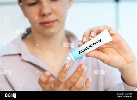Silver Nitrate Medical Cream Conceptual Image A Caustic Cream Used To