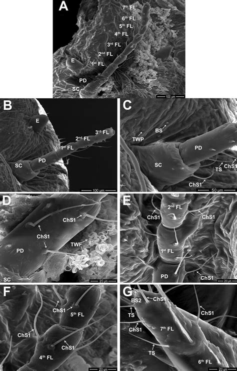 Scanning Electron Microscopy Sem Micrographs Of The Female Antenna Of Download Scientific