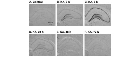 Micrographic Analysis Of The Time Course Of C Fos Protein Expression In