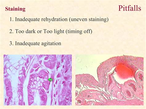 Tissue Processing In Histopathology Ppt