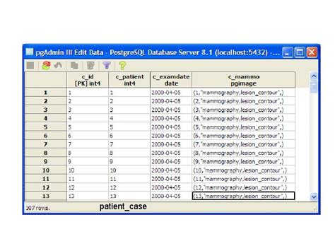 postgre sqlie an imagehandling extension for postgre sql