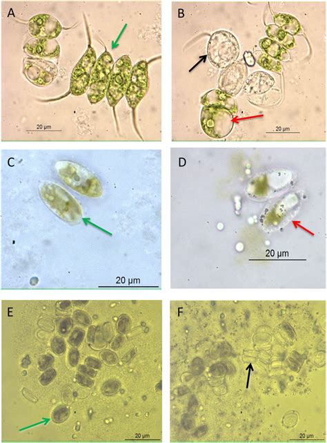 Representative Images From Microscopic Observations Of Algae After 30
