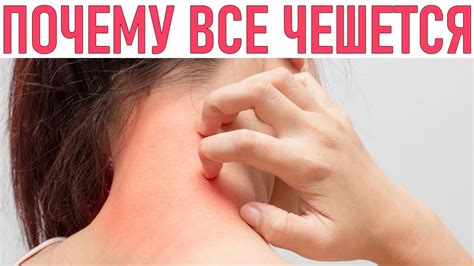 У МЕНЯ ВСЕ ЧЕШЕТСЯ ЧТО ДЕЛАТЬ 10 неожиданных причин почему у вас всё чешется Youtube