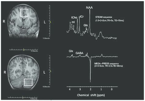 positions of the measurement voxel in acc anterior cingulate cortex