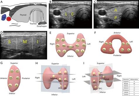 Thyroid Gland Nodule Biopsy At Nicholas Ducan Blog