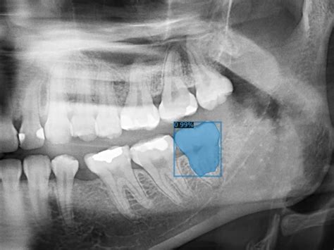 Deep Learning Model For Computer Vision And Nlp Tasks Upwork