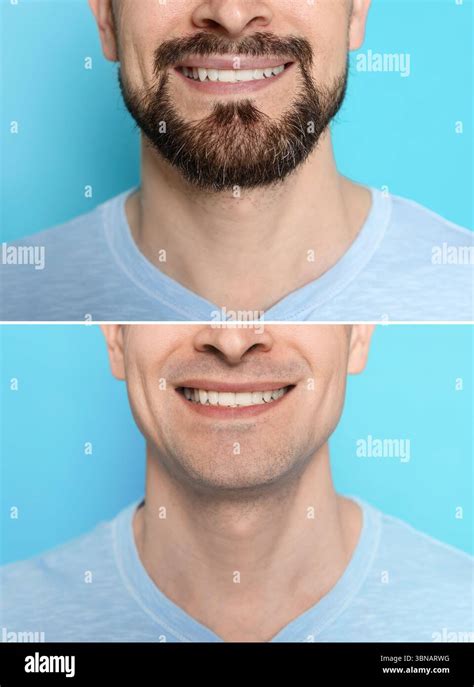 Man Before And After Shaving On Light Blue Background Closeup Collage