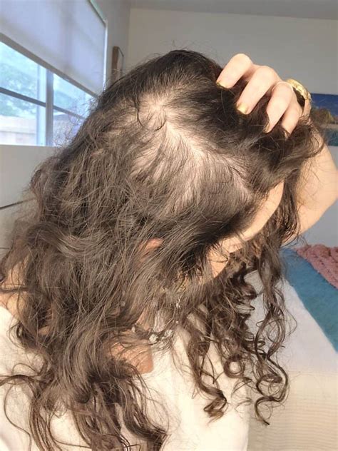 Low Density Hair Essential Tips And Volume Boosting Products You Need To
