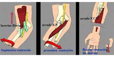 Compression Du Nerf Médian Au Coude Dr Houvet Spécialiste Des Nerfs