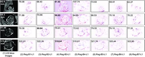 saliency maps of different regression cnns explained by lrp method the
