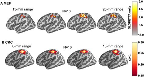 MEF A And CKC B Group Level Sources Projected On Inflated Brain Download Scientific Diagram