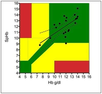 Error Grid Analysis Redrawn After Using A Linear Regression Plot Download Scientific