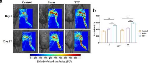 Tibial Cortex Transverse Transport Diabetic Wound Healing Jir