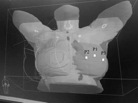 The Position Of Diode Detector On Patient S Skin Of The Contralateral Download Scientific