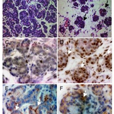 Disrupted branching morphogenesis in newborn β1glo MC mice a and b