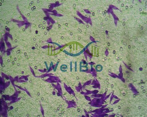 Transwell细胞功能实验服务维世尔生物