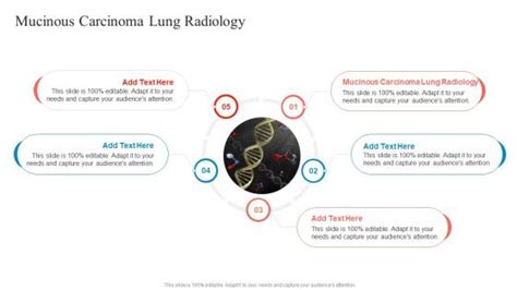 Mucinous Carcinoma Lung Radiology Powerpoint Presentation And Slides Ppt Powerpoint Slideteam