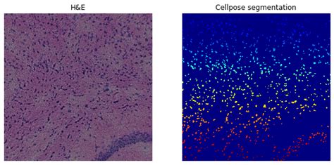 nuclei segmentation using cellpose — squidpy documentation