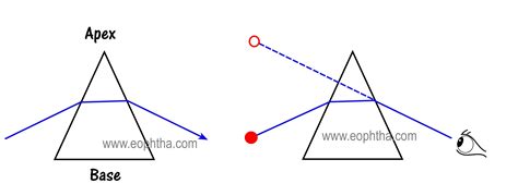 Fun With Prisms In Ophthalmology