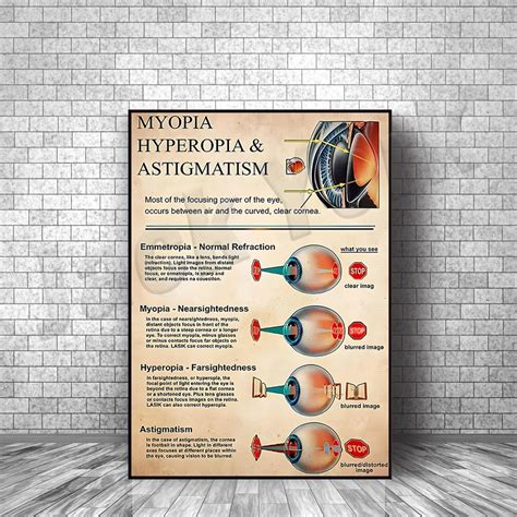 Myopia Hyperopia Astigmatism