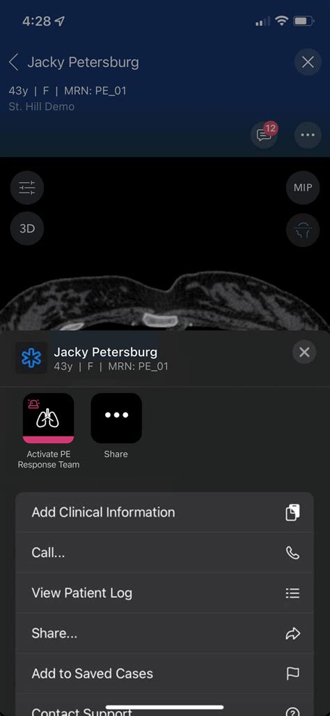 Viz Pe Ai Powered Care Coordination For Pulmonary Embolism