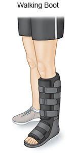 Walking Boot FAQs What You Need To Know