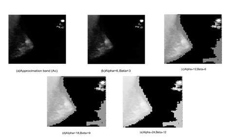 Resulted Images In Transform Domain For The Proposed Sigmoidal Download Scientific Diagram