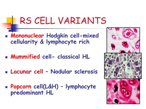 Classification Definition And Hodgkin Lymphoma For Bds Ppt