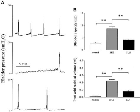 Figure 2 From Gene Therapy Using Replication Defective Herpes Simplex Virus Vectors Expressing