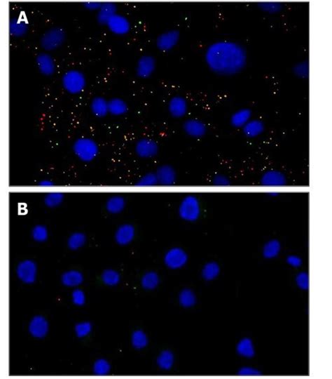 Duolink® Pla Multicolor Detection Protocol