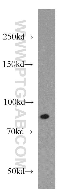 Runx1t1 Antibody 15494 1 Ap Proteintech