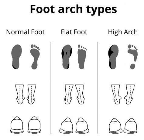 Three Arches Of The Foot