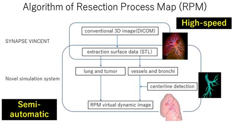 Evolution Of Three Dimensional Computed Tomography Imaging In Thoracic