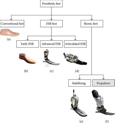Categorization Of Todays Prosthetic Feet With As Example A The Sach