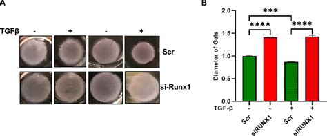Inhibition Of Runx1 Blocks The Differentiation Of Lung Fibroblasts To Myofibroblasts Pmc